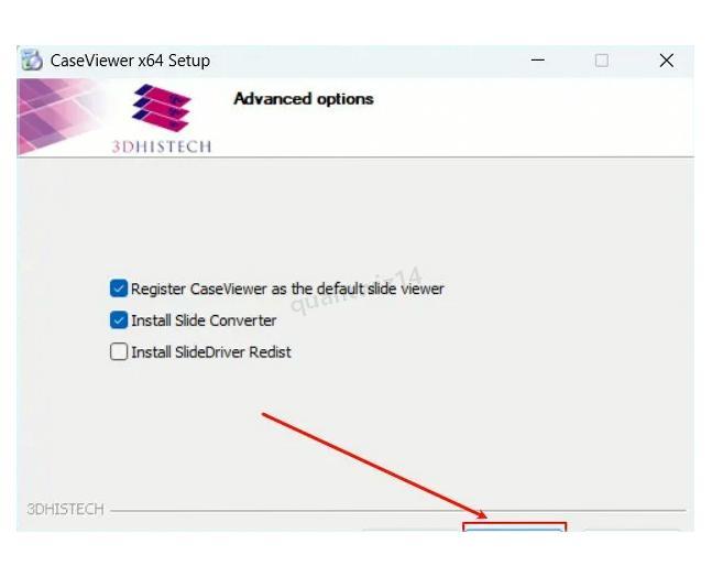 【2025】CaseViewer下载安装完全指南(附最新免费版) - quantwiz14 - 博客园